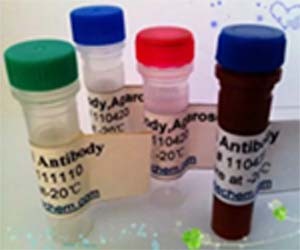 神经母细胞瘤相关蛋白ARID3B抗体